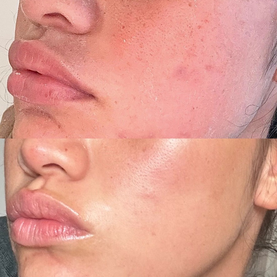 Biome Perfecting Oil – Biome Skin