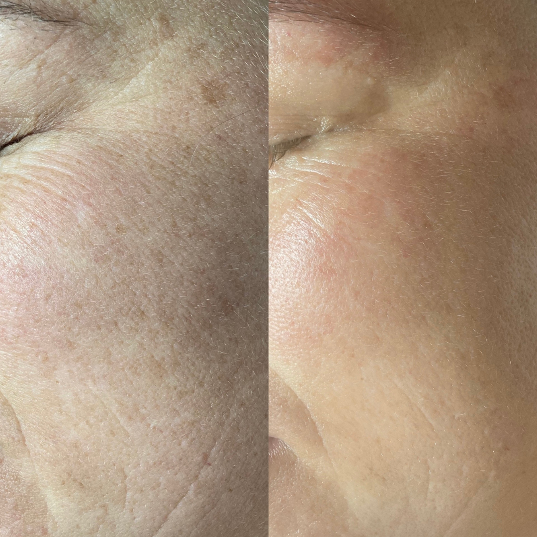Biome Perfecting Oil – Biome Skin