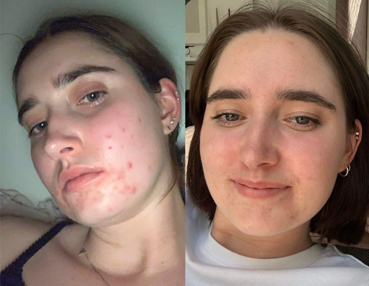 Biome Perfecting Oil 2 Week Trial | 5 ml – Biome Skin